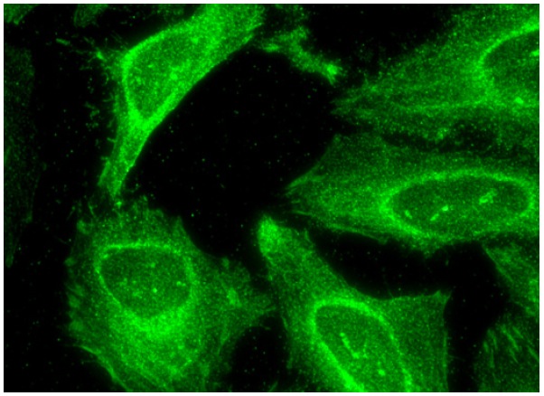 Septin 5 Antibody (H-9) | SCBT - Santa Cruz Biotechnology