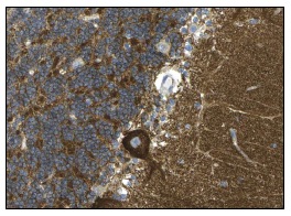 Anti-Septin 5 Antibody (SP18) | SCBT - Santa Cruz Biotechnology