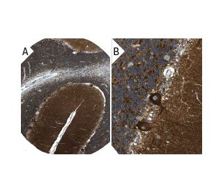Anti-Septin 5 Antibody (SP18) | SCBT - Santa Cruz Biotechnology