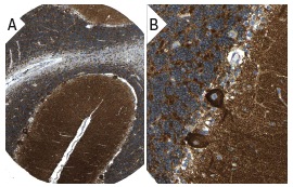 Anti-Septin 5 Antibody (SP18) | SCBT - Santa Cruz Biotechnology