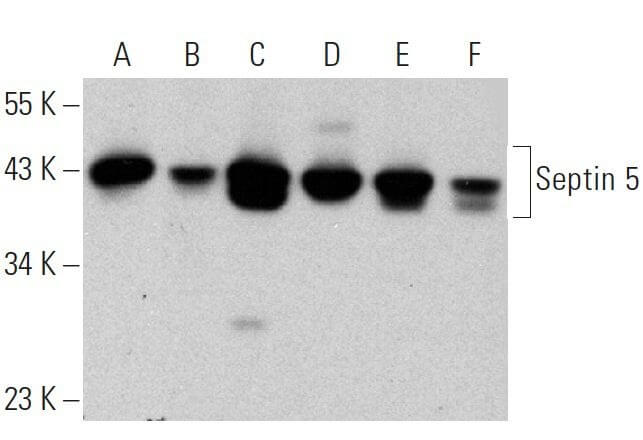Anti-Septin 5 Antibody (SP18) | SCBT - Santa Cruz Biotechnology