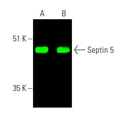 Anti-Septin 5 Antibody (SP18) | SCBT - Santa Cruz Biotechnology
