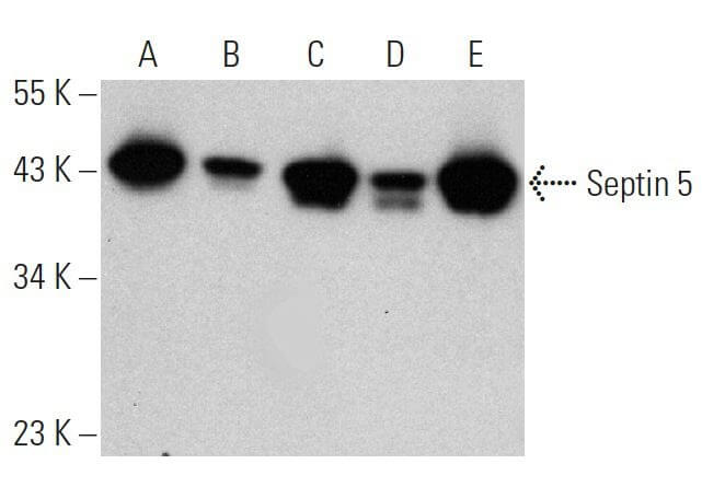 Septin 5 Antibody (SP19) | SCBT - Santa Cruz Biotechnology