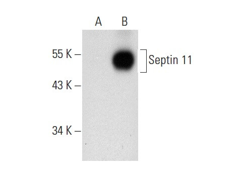 Anti-Septin Antibody (E-4) | SCBT - Santa Cruz Biotechnology