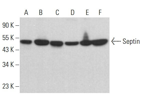 Anti-Septin Antibody (E-4) | SCBT - Santa Cruz Biotechnology
