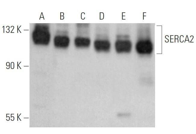 SERCA2抗体 (F-1) | SCBT - Santa Cruz Biotechnology