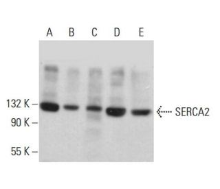 SERCA2 Antibody (F-1) - Western Blotting - Image 380504