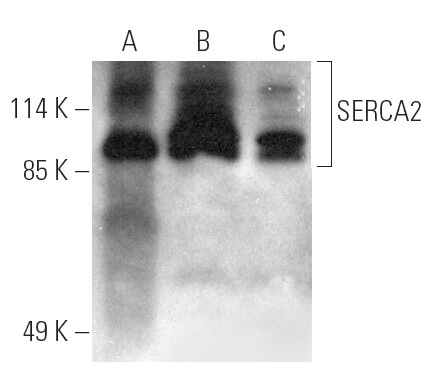 Anti-SERCA2 Antibody (F-1) | SCBT - Santa Cruz Biotechnology
