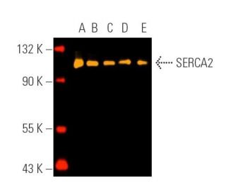 Anti-SERCA2 Antibody (F-1) | SCBT - Santa Cruz Biotechnology