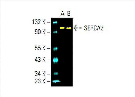 Anti-SERCA2 Antibody (F-1) | SCBT - Santa Cruz Biotechnology
