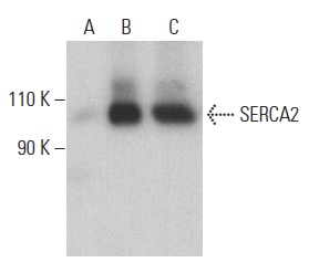 Anti-SERCA2 Antibody (F-1) | SCBT - Santa Cruz Biotechnology