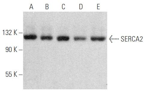 SERCA2 Antibody (IID8) | SCBT - Santa Cruz Biotechnology