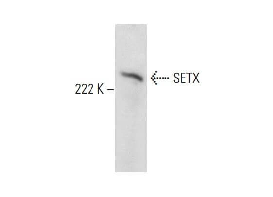 SETX抗体 (QQ-7) | SCBT - Santa Cruz Biotechnology