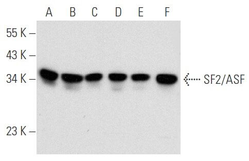 SF2/ASF抗体 (96) | SCBT - Santa Cruz Biotechnology