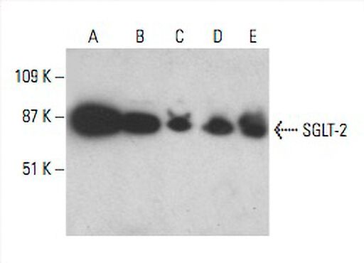 SGLT-2 Antibody (D-6) | SCBT - Santa Cruz Biotechnology