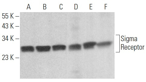 Anti-Sigma Receptor Antibody (B-5) | SCBT - Santa Cruz Biotechnology