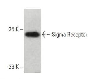 Anti-Sigma Receptor Antibody (B-5) | SCBT - Santa Cruz Biotechnology