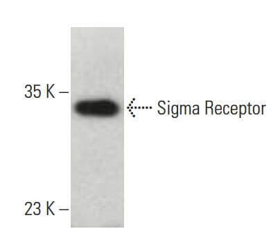 Anti-Sigma Receptor Antibody (B-5) | SCBT - Santa Cruz Biotechnology