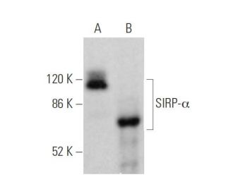 Anti-SIRP-α Antibody (SE7C2) | SCBT - Santa Cruz Biotechnology
