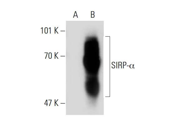 SIRP-α/β Antibody (148) | SCBT - Santa Cruz Biotechnology