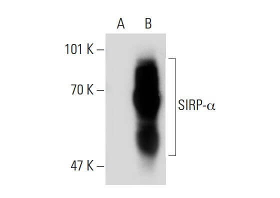 SIRP-α/β Antibody (148) | SCBT - Santa Cruz Biotechnology