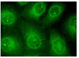 SIRP-α/β1 Antibody (A-1) | SCBT - Santa Cruz Biotechnology