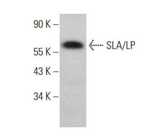 SLA/LP Antibody (E-11) | SCBT - Santa Cruz Biotechnology
