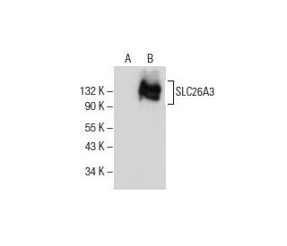 SLC26A3 Antibody (H-8) - Western Blotting - Image 154528