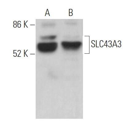 SLC43A3抗体 (E-10) | SCBT - Santa Cruz Biotechnology