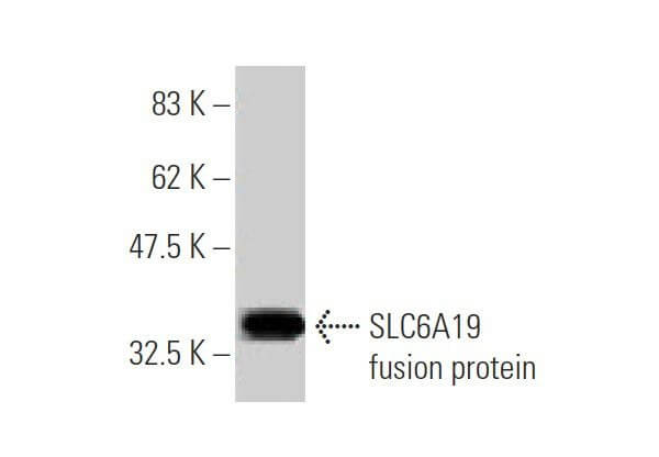 SLC6A19 Antibody (4F11) | SCBT - Santa Cruz Biotechnology