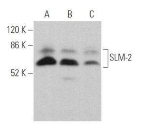 SLM-2抗体 (F-3) | SCBT - Santa Cruz Biotechnology