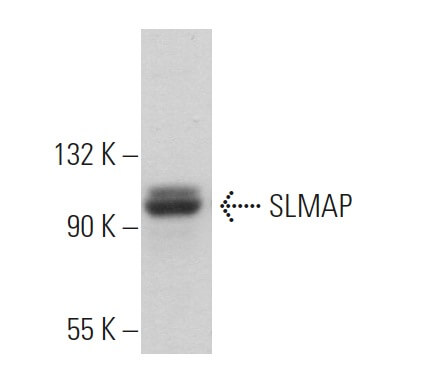 SLMAP Antibody (B-9) | SCBT - Santa Cruz Biotechnology