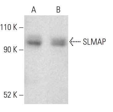 SLMAP Antibody (B-9) | SCBT - Santa Cruz Biotechnology