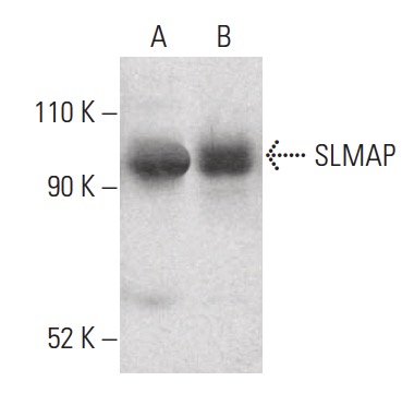 SLMAP Antibody (B-9) | SCBT - Santa Cruz Biotechnology
