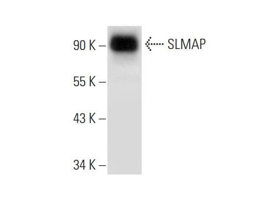 SLMAP Antibody (D-3) | SCBT - Santa Cruz Biotechnology