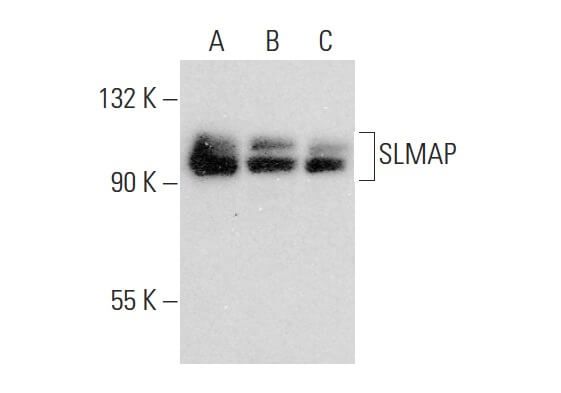 SLMAP Antibody (SJ-09) | SCBT - Santa Cruz Biotechnology