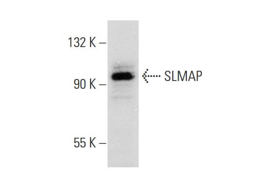 Anti-SLMAP Antibody (SJ-09) | SCBT - Santa Cruz Biotechnology