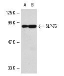 SLP-76 Antibody (F-7) | SCBT - Santa Cruz Biotechnology