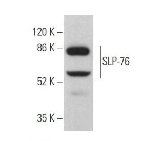 Anti-SLP-76 Antibody (F-7) | SCBT - Santa Cruz Biotechnology