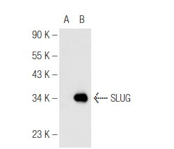 Anti-SLUG Antibody (A-7) | SCBT - Santa Cruz Biotechnology