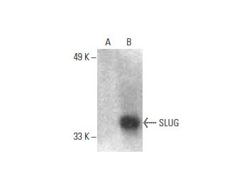 Anti-SLUG Antibody (A-7) | SCBT - Santa Cruz Biotechnology