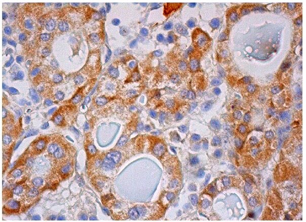 Smad2/3 Antibody (E-1) | SCBT - Santa Cruz Biotechnology