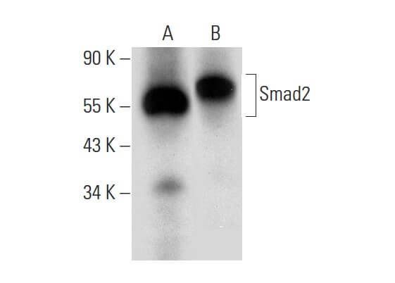 Smad2抗体 (A-11) | SCBT - Santa Cruz Biotechnology