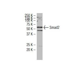 Smad2 Antibody (YZ-13) - Western Blotting - Image 34513