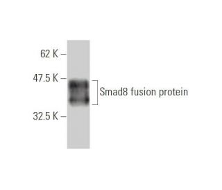 Smad8 Antibody (R-64) | SCBT - Santa Cruz Biotechnology