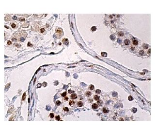 SMC3 Antibody (E-3) - Immunohistochemistry - Image 157916