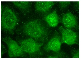 SmcX Antibody (G-10) | SCBT - Santa Cruz Biotechnology