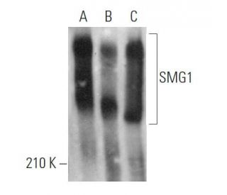 Anti-SMG1 Antibody (E-4) | SCBT - Santa Cruz Biotechnology