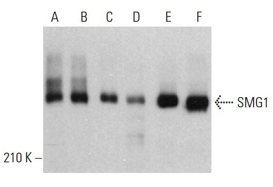 SMG1 Antibody (E-4) | SCBT - Santa Cruz Biotechnology