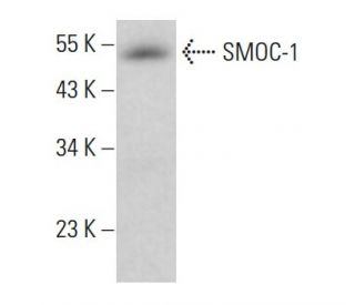SMOC-1 Antibody (A-10) | SCBT - Santa Cruz Biotechnology
